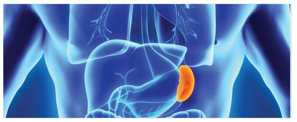Splenectomy in Sickle Cell Disease: Do Benefits Outweigh Risks? – TIF